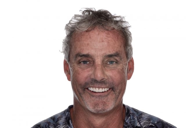 Replacing Thailand Veneers | City Dental